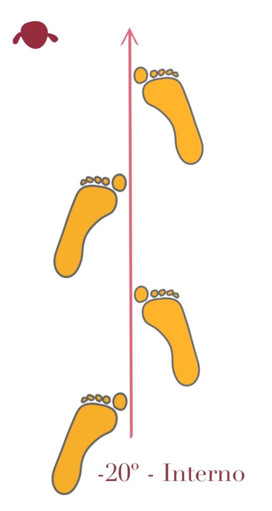 Mete los pies al andar – Mi Nieta Cojea